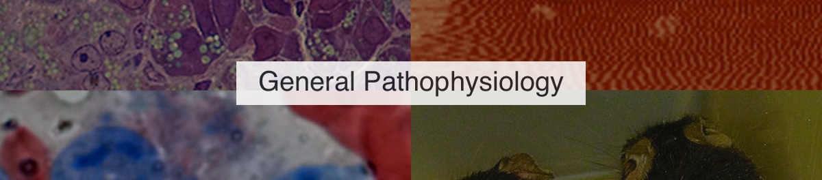 Reddit comments on "General Pathophysiology" Coursera course | Reddsera