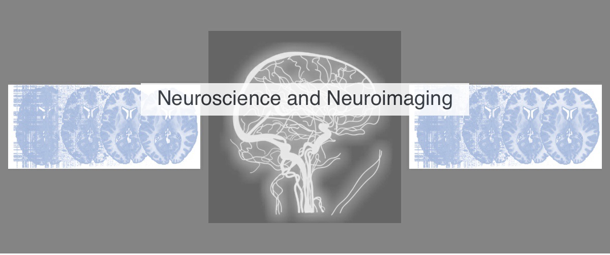 Reddit comments on "Neuroscience and Neuroimaging" Coursera course ...